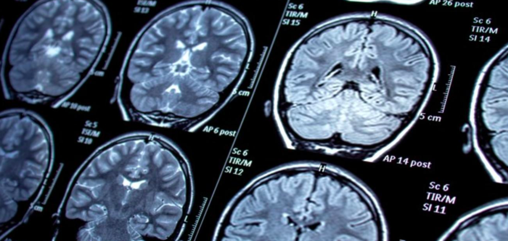 New imaging technologies allow for 3D imaging of the human brain | Imaging and Machine Vision Europe